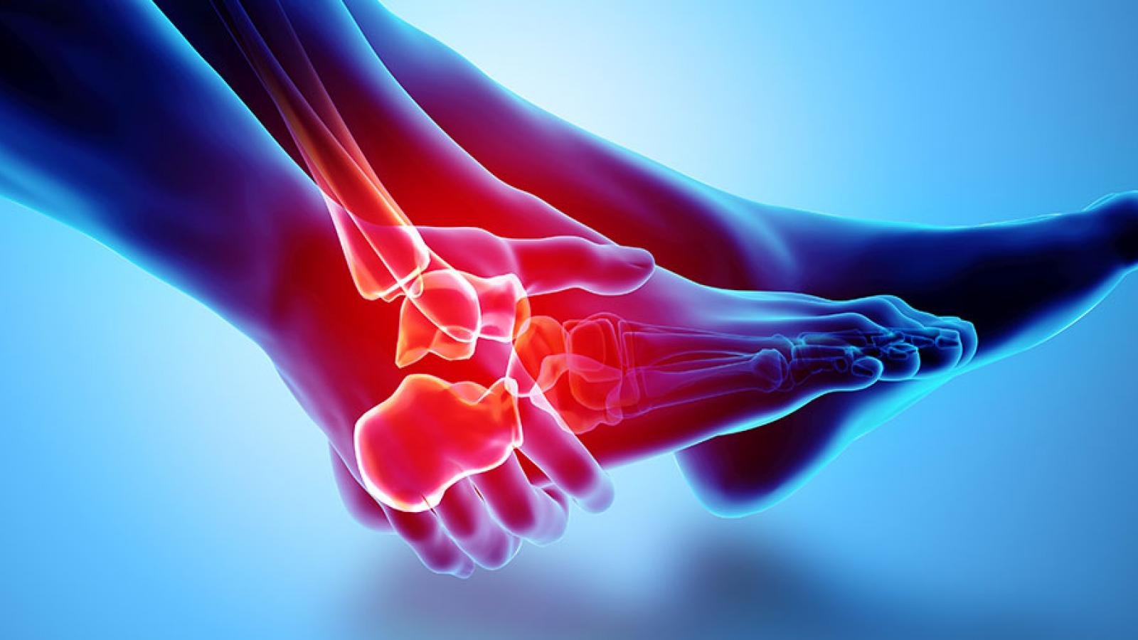Ankle - Matthewson Orthopedics